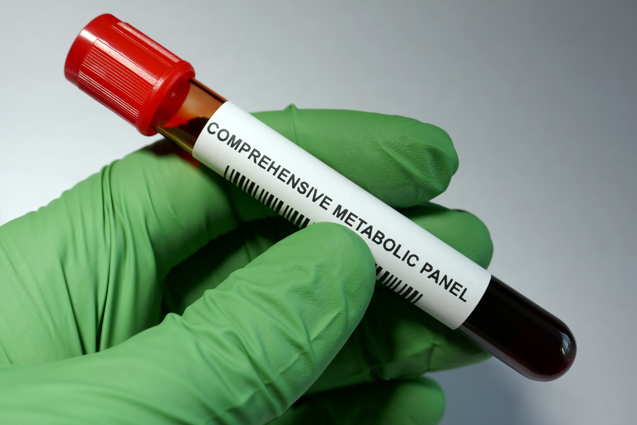 What Is A Comprehensive Metabolic Panel News Digest Healthy Options